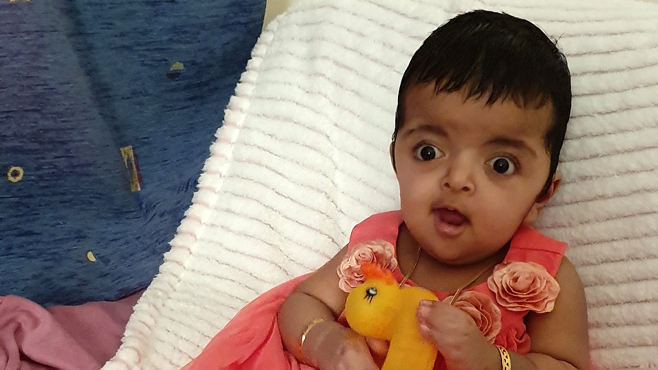 Sidra Medicine Performs Groundbreaking Surgeries on Children with Apert ...